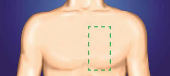 Streekziekenhuis Koningin Beatrix - patiëntfolder: Inwendige ...