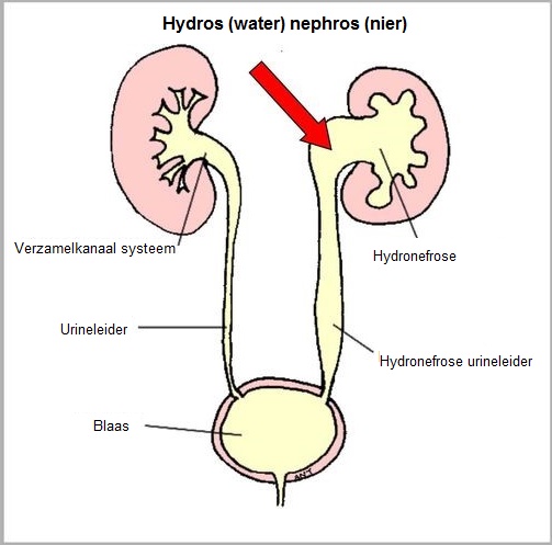 Streekziekenhuis Koningin Beatrix - patiëntfolder: Opstapeling urine in ...