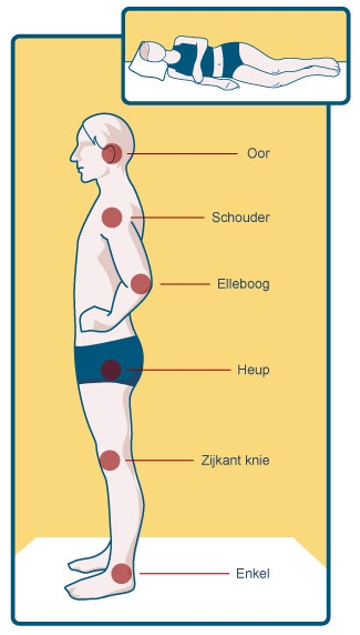 Streekziekenhuis Koningin Beatrix - patiëntfolder: Decubitus (doorliggen)